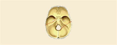 Longitudinal Temporal Bone Fracture Vs Transverse Temporal Bone Fractu Knya