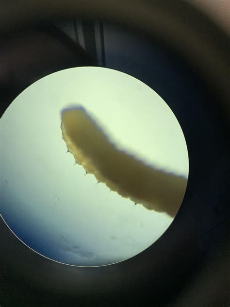 What Is This Worm Hookworm Pg 215 R Parasites
