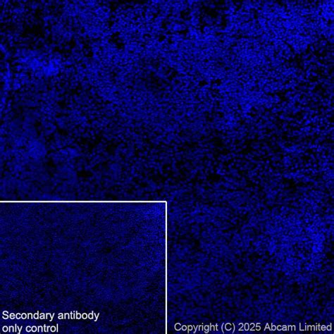 Anti Eph Receptor A4sek Antibody Epr30307 560 Ab324353 Abcam
