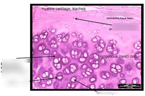 Hyaline Cartilage Trachea Figure 20 2 8 Trachea The Mucosa Lines