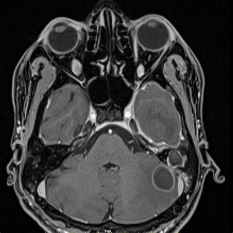 Radiology Manipal Hospital