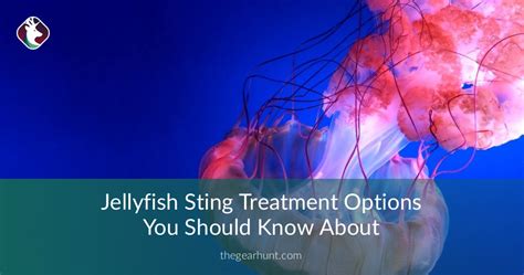 Jellyfish Sting Treatment Options You Should Know About Thegearhunt