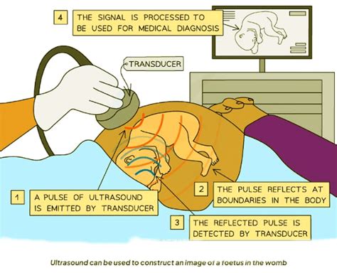 Ultrasound Physics For Gcseigcse Year 11 Pdf Download