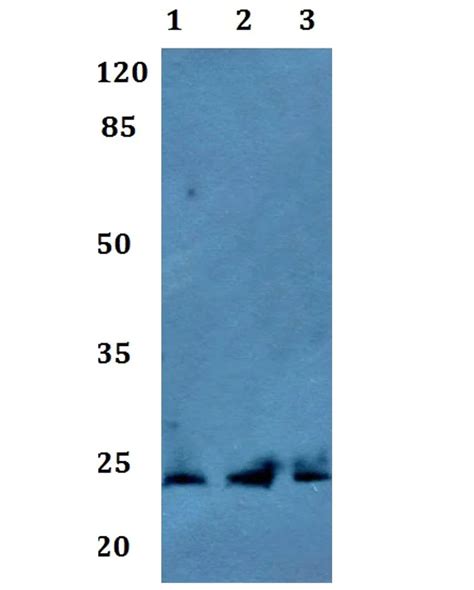 Anti Claudin 9 Antibody Ab192398 Abcam