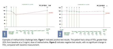 Challenging The Diagnosis Of Asthma With Methacholine Consultant360