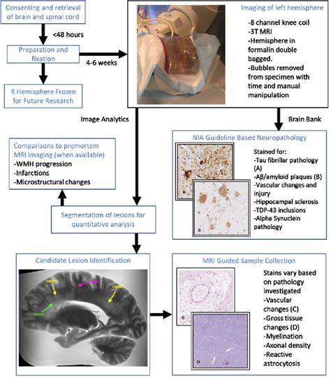 Figure 1 From Postmortem Brain Imaging In Alzheimers Disease And