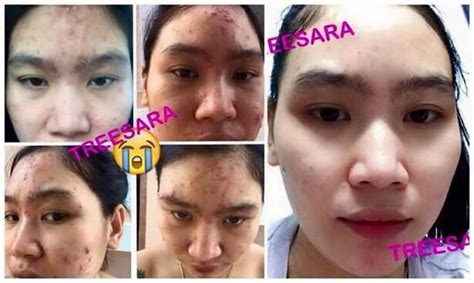 Tree Sara Restaurant Tailandia Restaurant Reviews