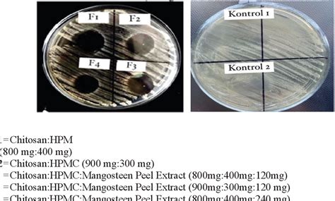 Figure 2 From Formulation Of Acne Patch From Garcinia Mangostana L Peel Extract With A