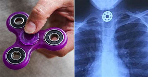 Los Peligros Ocultos De Los Fidget Spinner Que Se Venden En Argentina