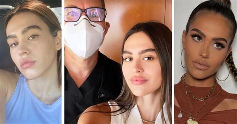 Amelia Hamlins Transformation All The Details On Her Plastic Surgery