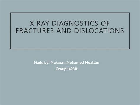 X Ray Diagnostics Of Fractures And Dislocations Pptx
