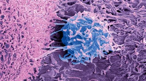 The Mystery Of Microbes That Live Inside Tumours Bbc Future