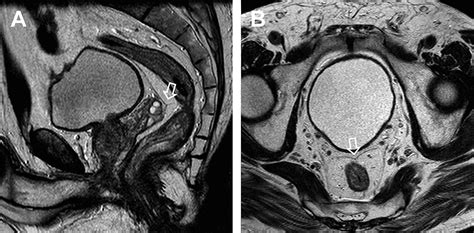 Rectal Cancer Magnetic Resonance Imaging Clinics