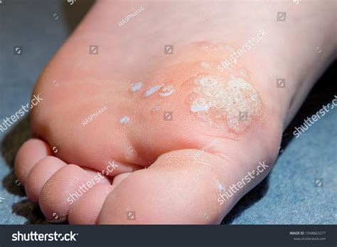 31件の「mosaic Wart」の画像、写真素材、ベクター画像 Shutterstock