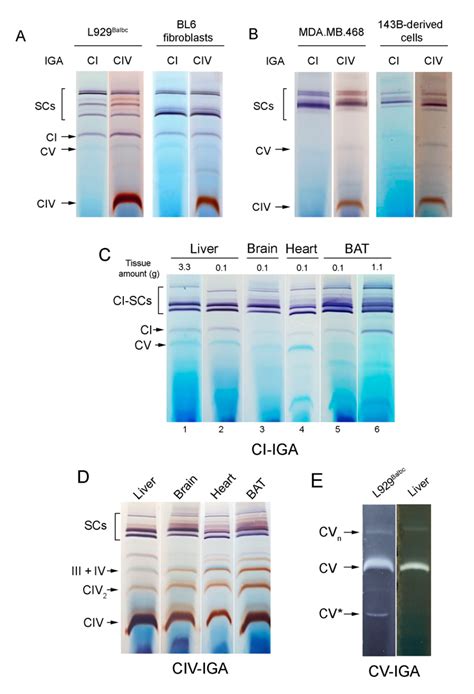 Isolation Of Mitochondria For Mitochondrial Supercomplex Analysis From