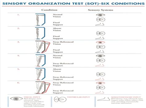What Is A Sensory Organization Test At Guy Melvin Blog