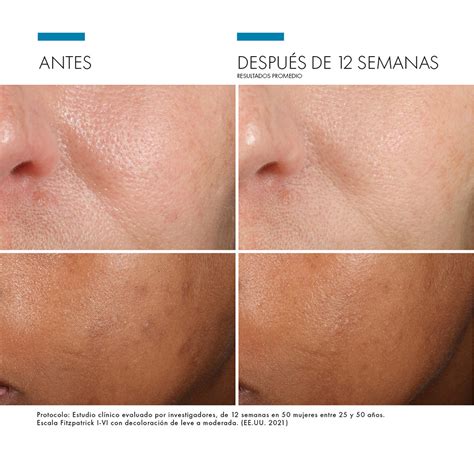 Phloretin Cf Serum 30 Ml Yoskin