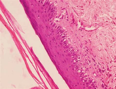 H And E Stained Section Shows Prominent Granular Cell Layer 40× Download Scientific Diagram