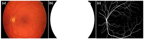 Electronics Free Full Text An Automated Image Segmentation And Useful Feature Extraction