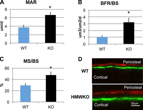 Dynamic Histomorphometric Analysis Of Cortical Bone Of Femurs From Wt
