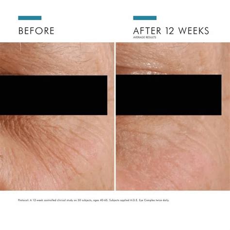 Skinceuticals Age Eye Complex — M Dika Dermatology