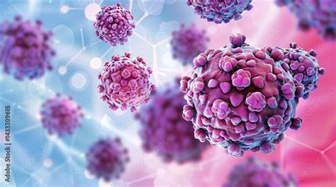 Lymphadenopathy Deciphering The Mystery Of Swollen Lymph Nodes And