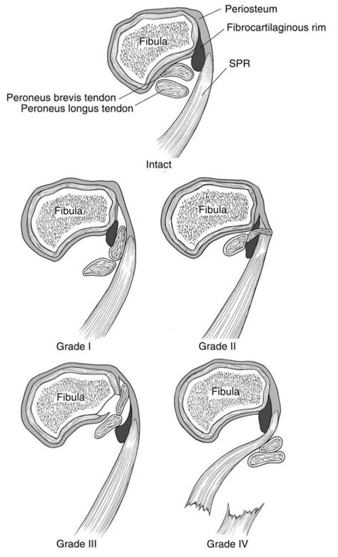 Funtabulously Frivolous Friday Five 275 • Litfl