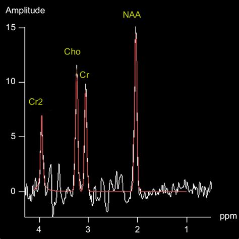 Sample Of Chemical Shift Imaging Spectra From A Subject Notes Peak Download Scientific