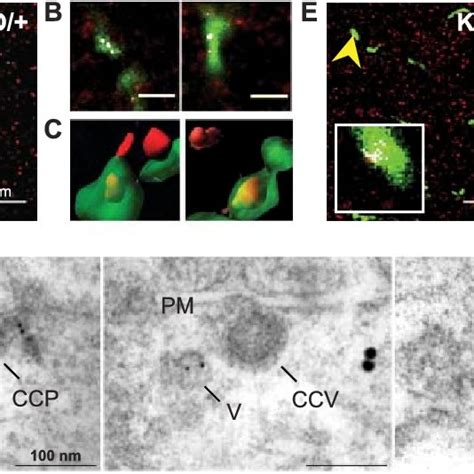 Pdf Synaptic Pruning By Microglia Is Necessary For Normal Brain