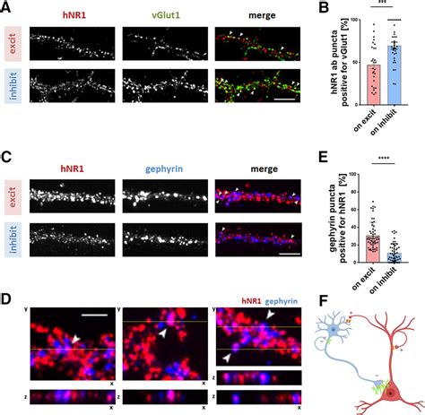 Patient Derived Anti Nmdar Antibody Disinhibits Cortical Neuronal