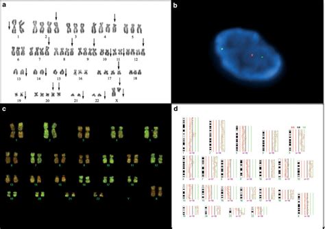 Karyogram From A Cell Of Tumor 1 Displaying Multiple Numerical