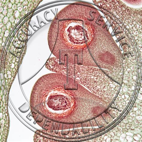 Lycopersicum Esculentum Fruit Prepared Microscope Slide