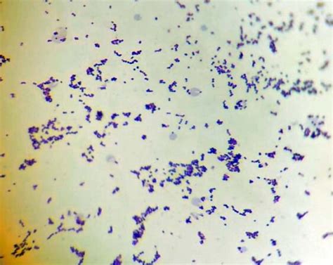 Streptococcus Pneumoniae Under Microscope