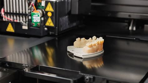 Digital Workflow For Implant Prostheses Decisions In Dentistry