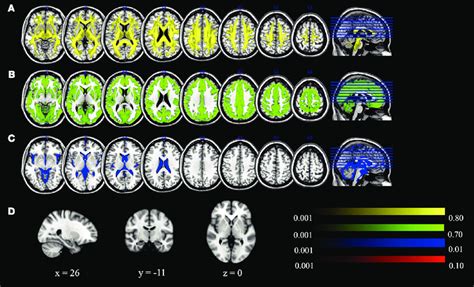 Maximum Ratio Images Computed Across The Entire Fractional Anisotropy