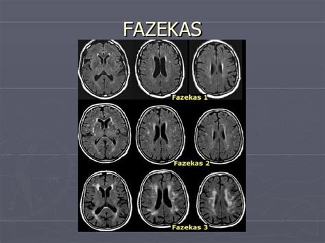 Snc Clase Episodio Ii