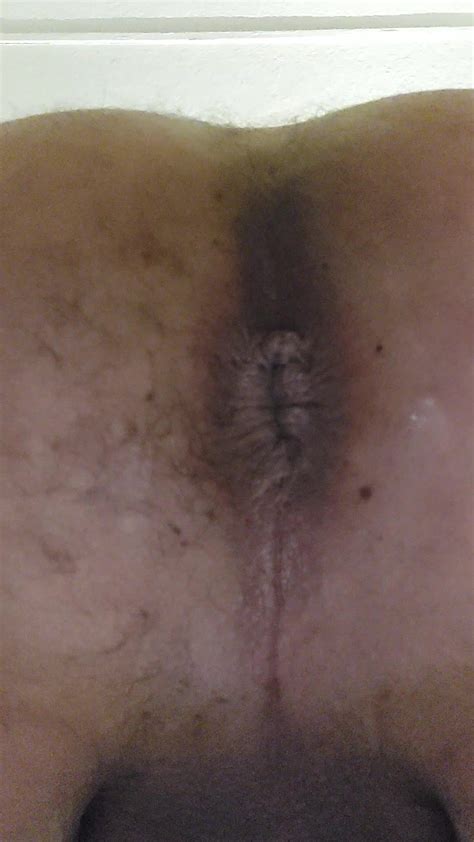 Speculum Fun Thisvid Com