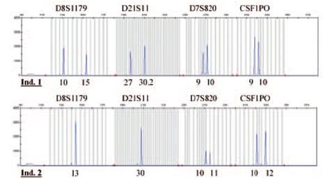Str Marker Separation Electropherograms Illustrating Size Separation