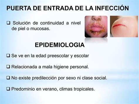 5 Dermatitis Bacteriana Ppt