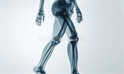 A Skeleton Of A Person With A Knee Bent Stock Illustration Illustration Of Human Male 351792113