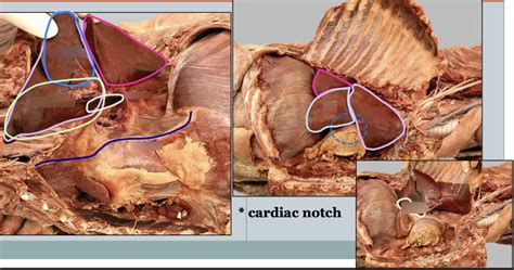 Lung Dissection Pt 2 Diagram Quizlet