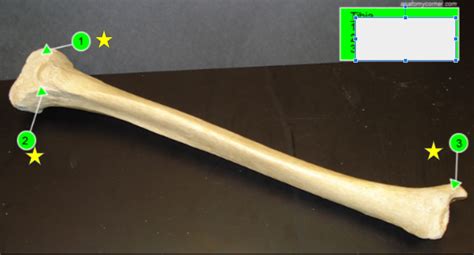 Tibia Diagram Quizlet