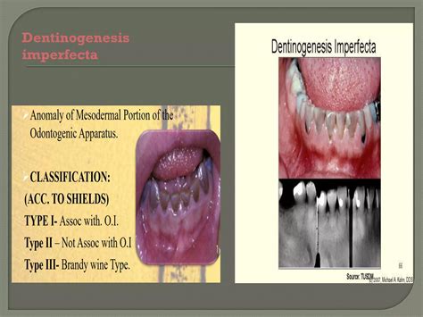 Dentin Pdf