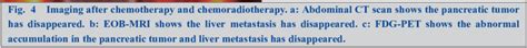 Imaging After Chemotherapy And Chemoradiotherapy A Abdominal Ct Scan Download Scientific