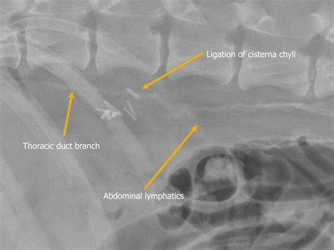 Ppt Lymphangiography Powerpoint Presentation Free Download Id5494224