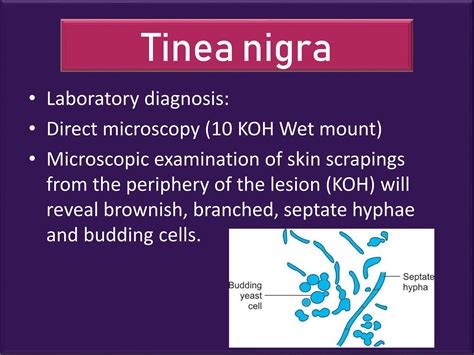 Tinea Nigra Hortaea Werneckiippt Pptx