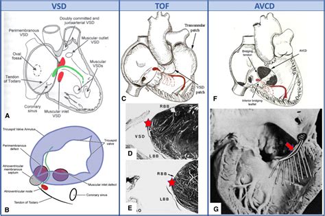 Conduction In The American Association For Thoracic Surgery Aats