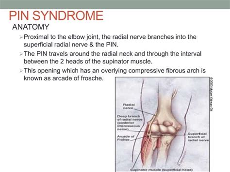 Entrapment Neuropathy Of The Upper Limb Pptx