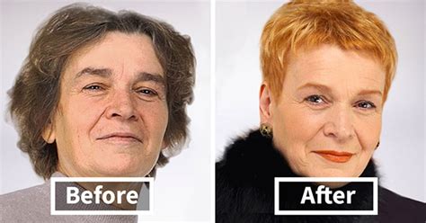 Extreme Makeovers Before And After