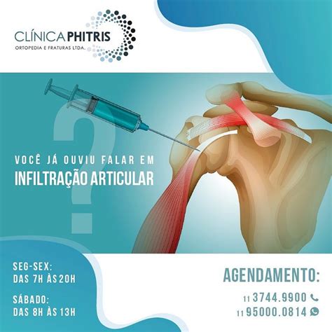 Clínica Phitris A Infiltração Articular é Uma Técnica